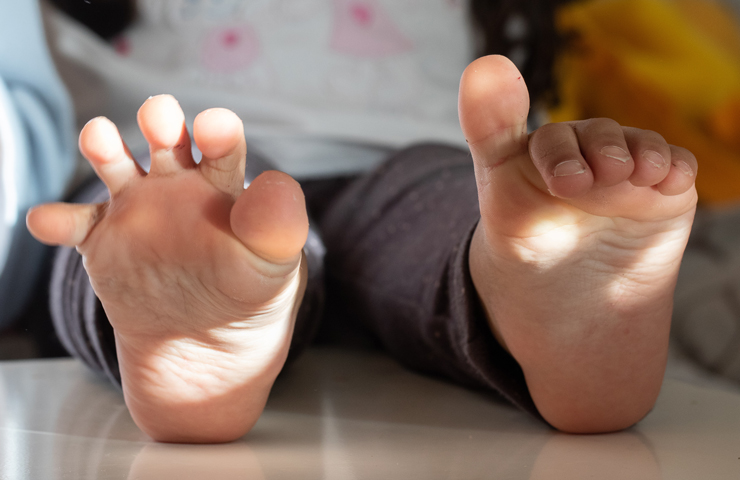 L'association Alliance Arthrogrypose prône l'échange des conseils pour ...